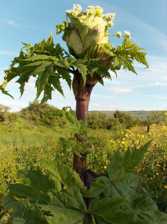 Treating giant hogweed burns