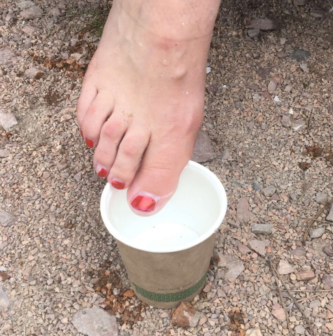 Weever Fish - What to do if you get stung - First Aid Training Co-operative
