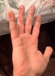 Aaaar! - First Aid for Pirates - First Aid Training Cooperative